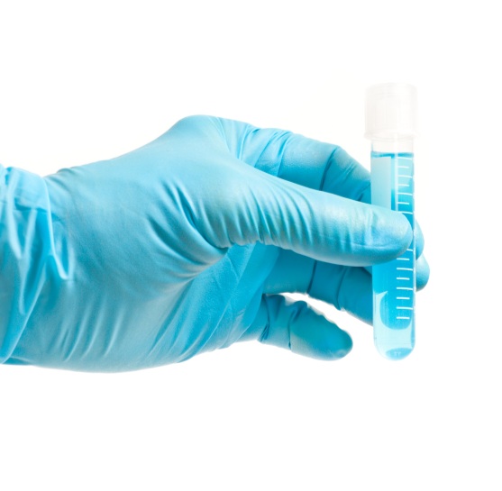 Acid Phosphatase Blood Test