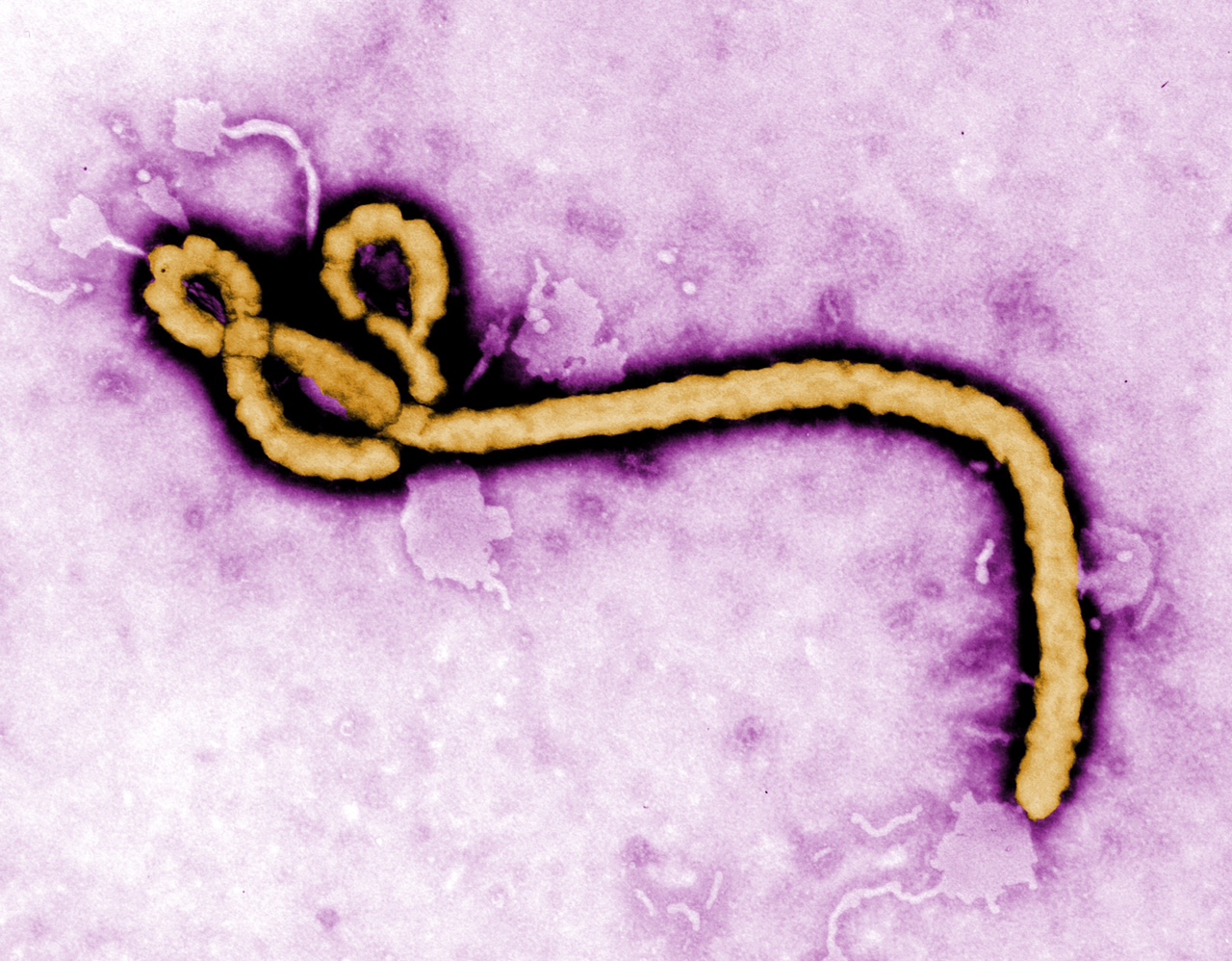 Ebola Virus Disease (EVD)