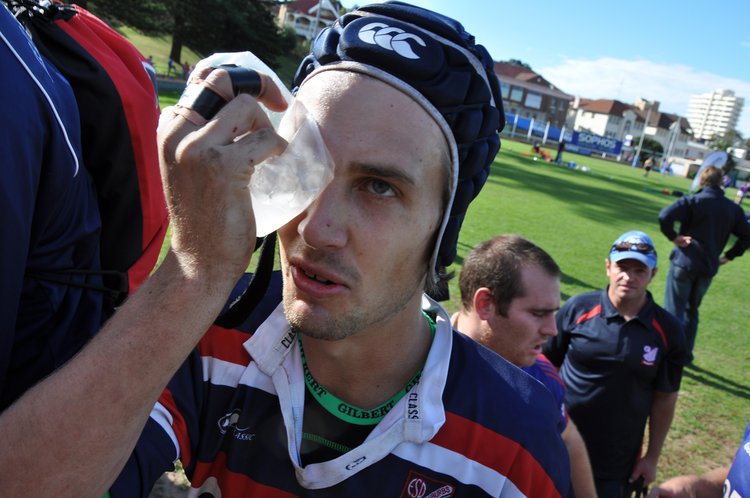 Eye Injuries in Sports