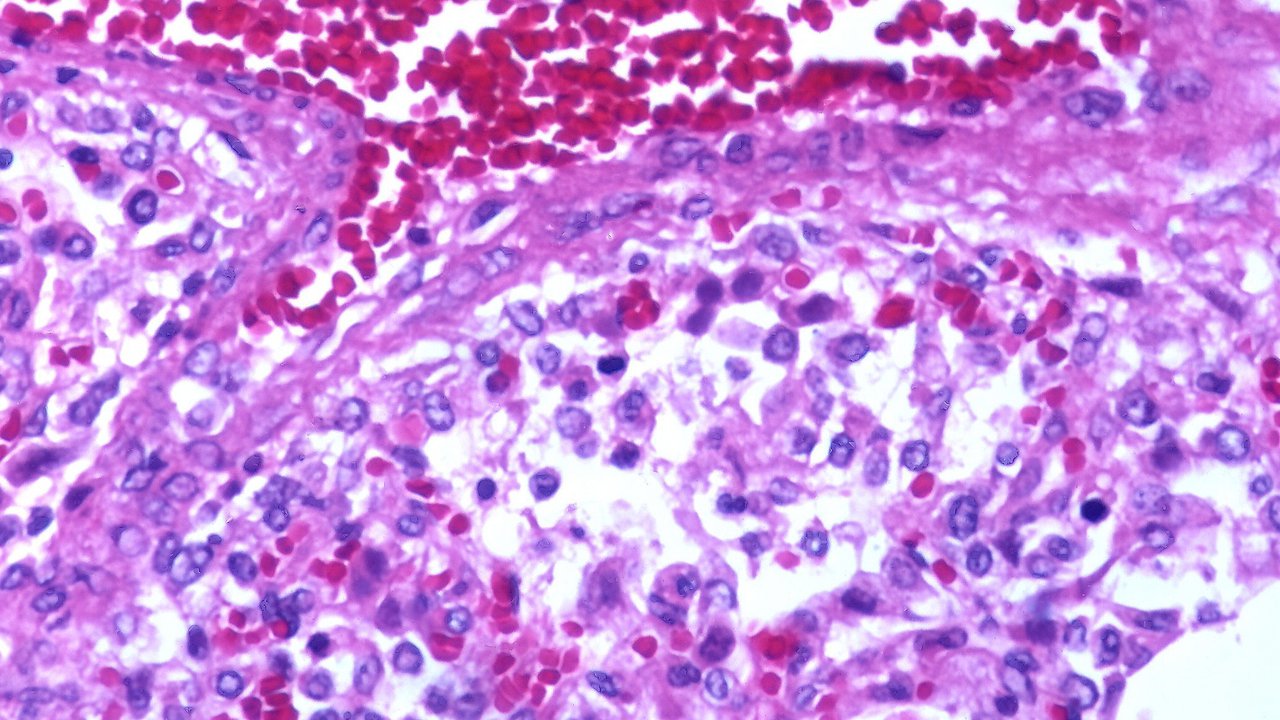 How well do you know Adenovirus Infection