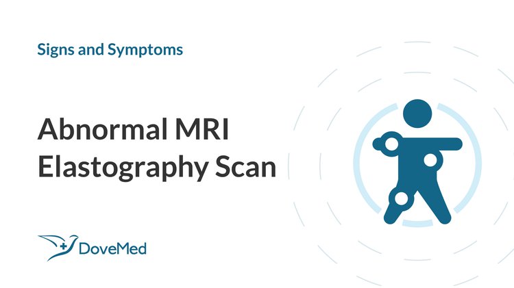Abnormal MRI Elastography Scan