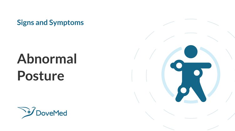 Abnormal Posture