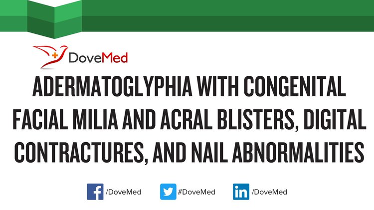 Adermatoglyphia with Congenital Facial Milia and Acral Blisters ...