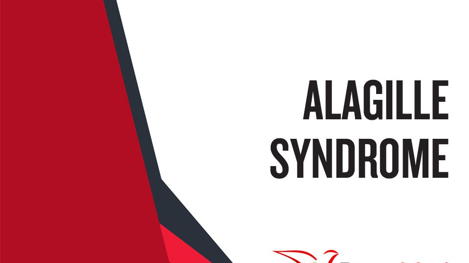 How well do you know Alagille Syndrome?