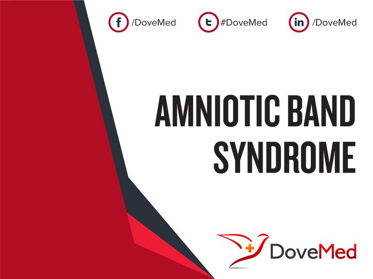 amniotic-band-syndrome