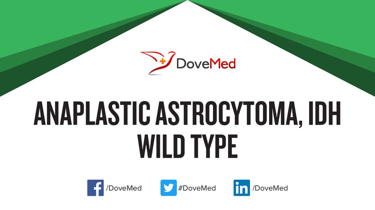 Anaplastic Astrocytoma, IDH Wild type