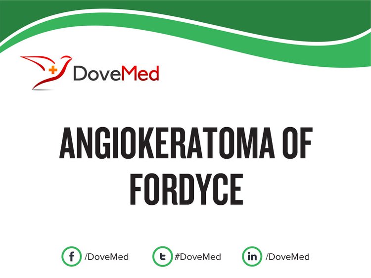Angiokeratoma of Fordyce (affecting Vulva)