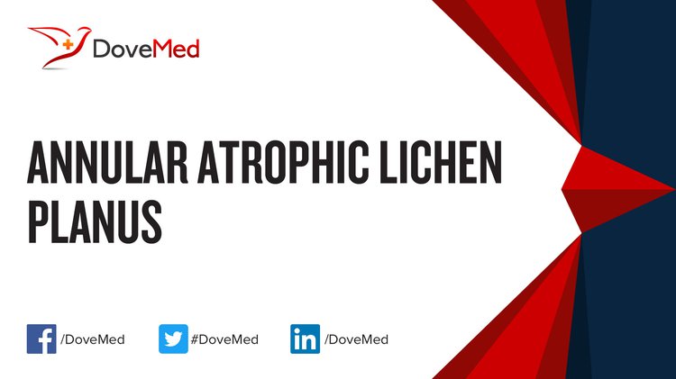 Annular Atrophic Lichen Planus