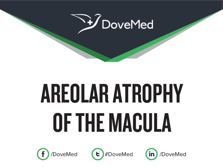 Areolar Atrophy of the Macula