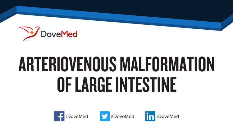 Arteriovenous Malformation of Large Intestine