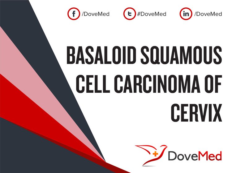 Basaloid Squamous Cell Carcinoma of Cervix