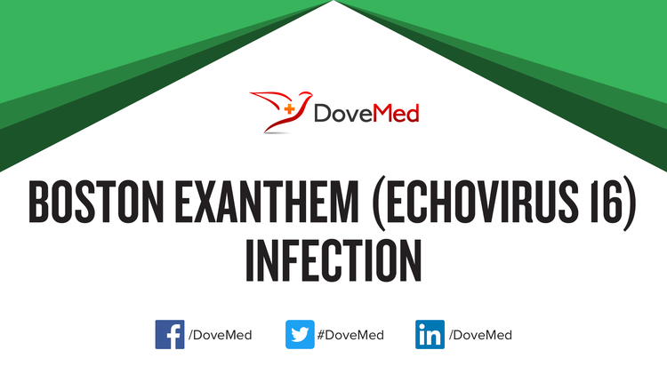 Boston Exanthem (Echovirus 16) Infection