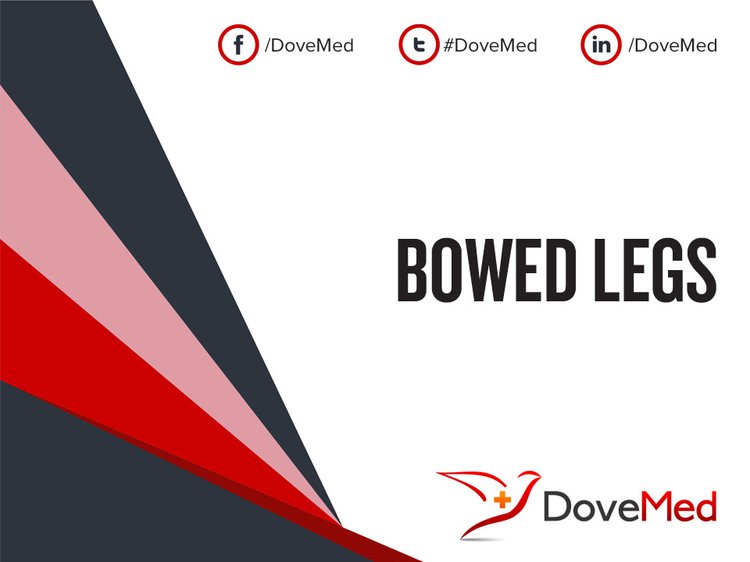 Bowed Legs