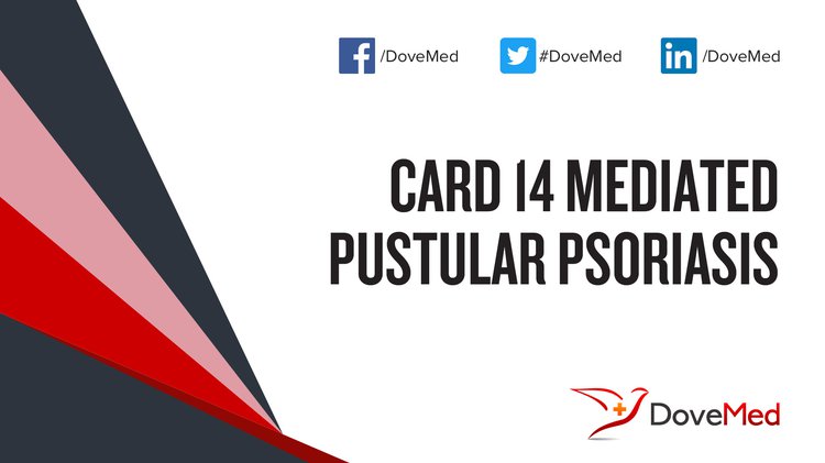 CARD 14 Mediated Pustular Psoriasis