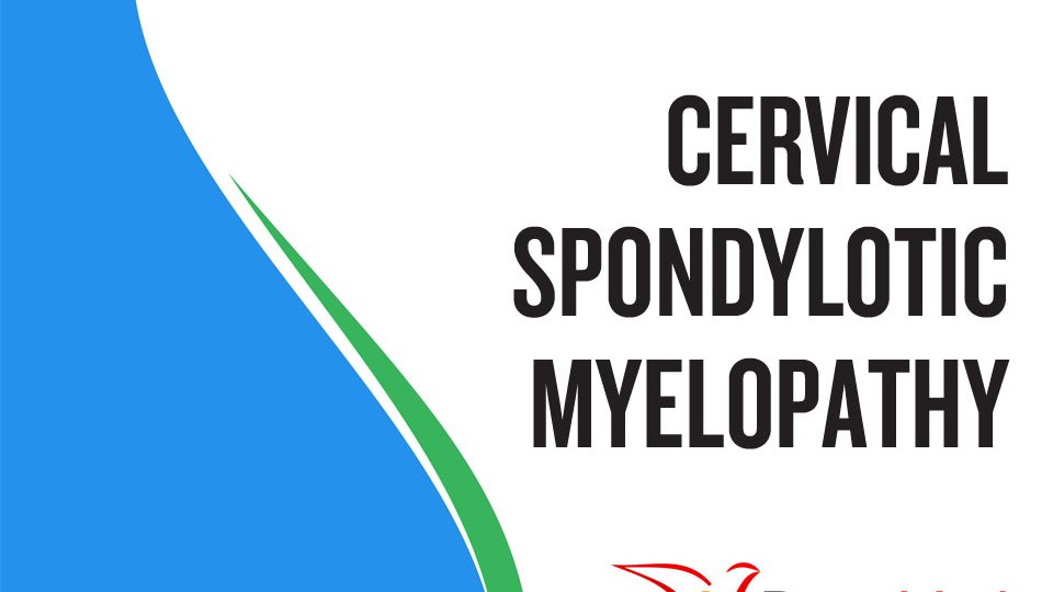 How well do you know Cervical Spondylotic Myelopathy (CSM)?