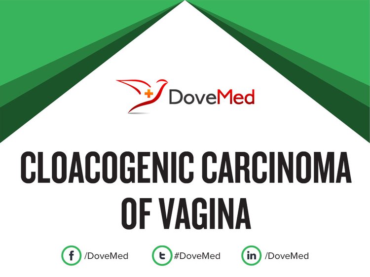 Cloacogenic Carcinoma of Vagina