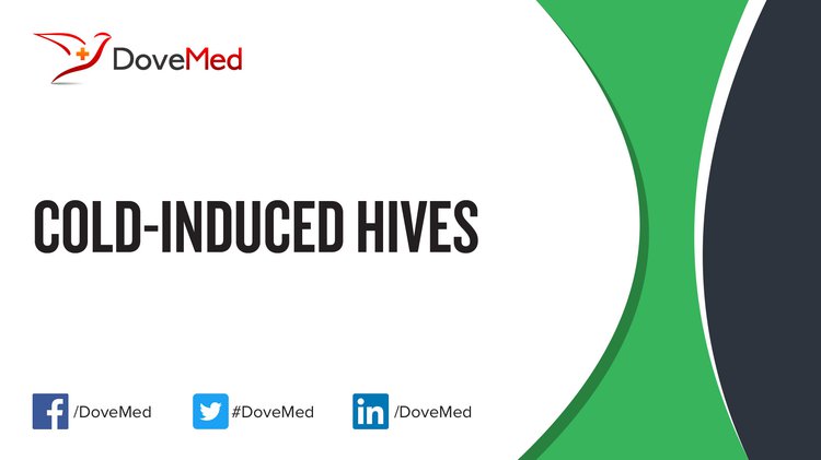 Cold-Induced Hives