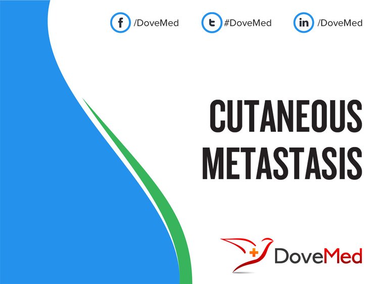 Cutaneous Metastasis