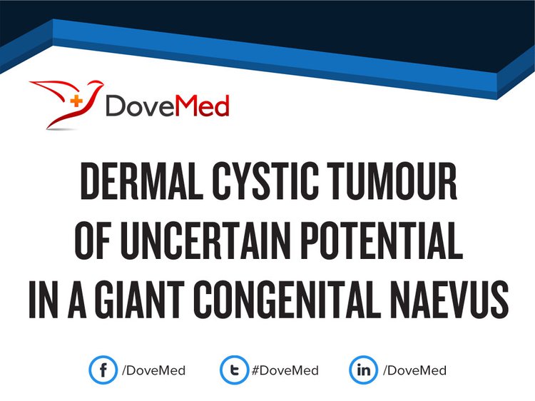 Dermal Cystic Tumour of Uncertain Potential in a Giant Congenital Naevus