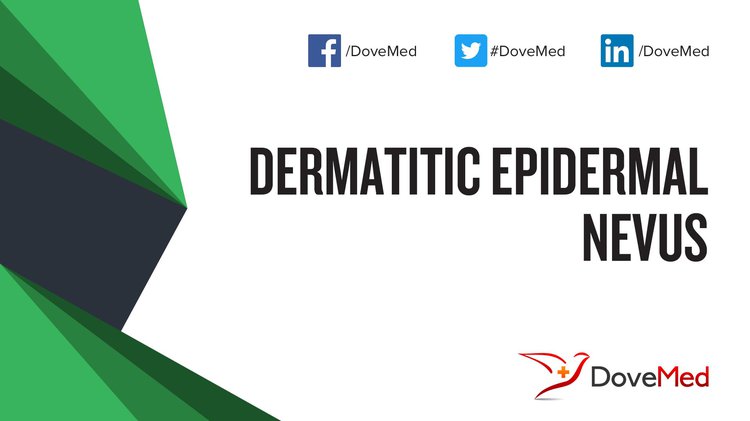 Dermatitic Epidermal Nevus