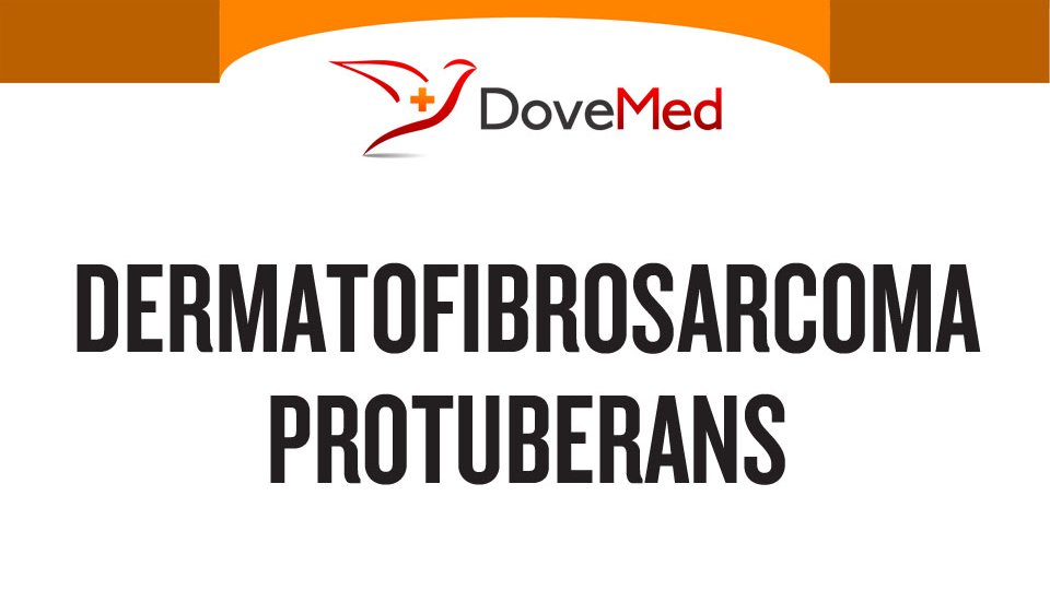 How well do you know Dermatofibrosarcoma Protuberans (DFSP)?