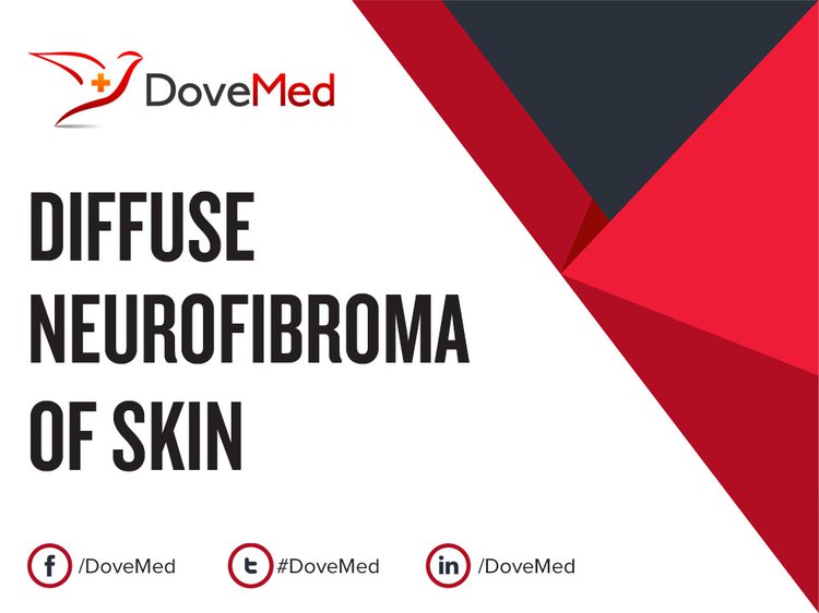 Diffuse Neurofibroma Of Skin