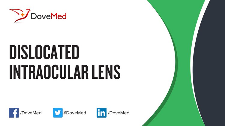 Dislocated Intraocular Lens