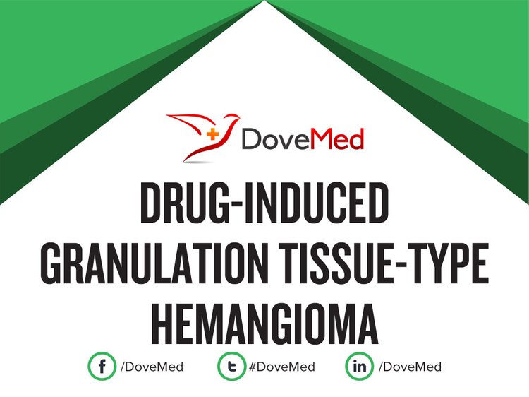 Drug-Induced Granulation Tissue-Type Hemangioma