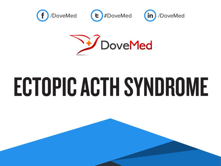 Ectopic ACTH Syndrome