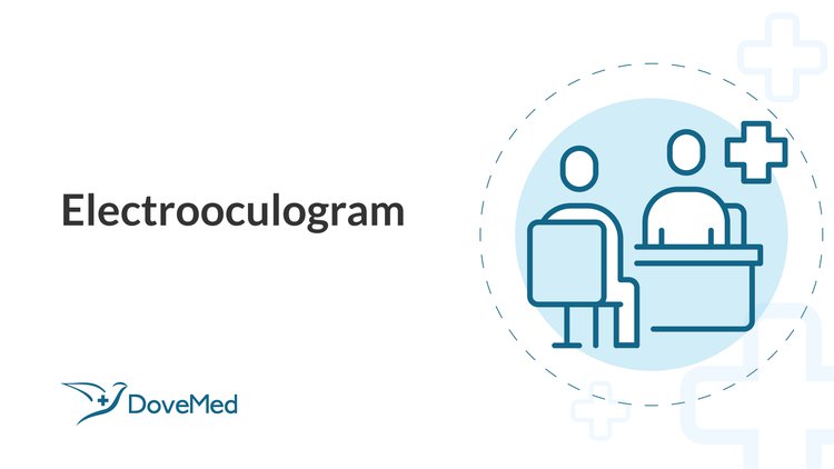 Electrooculogram