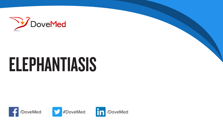 Elephantiasis