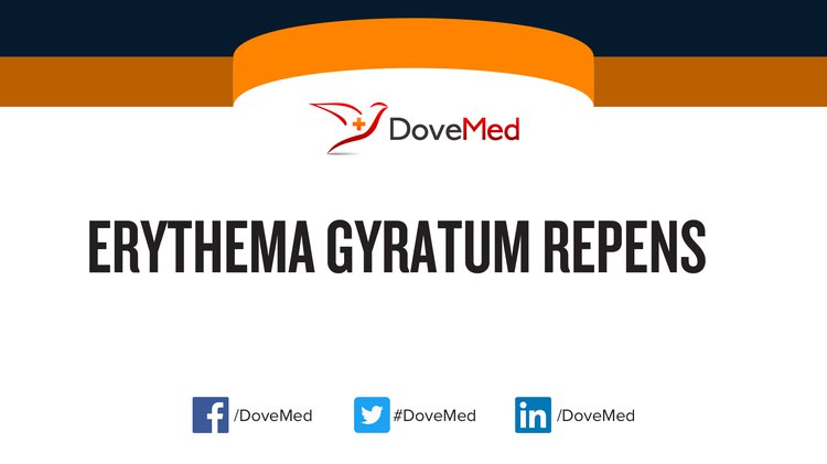 Erythema Gyratum Repens