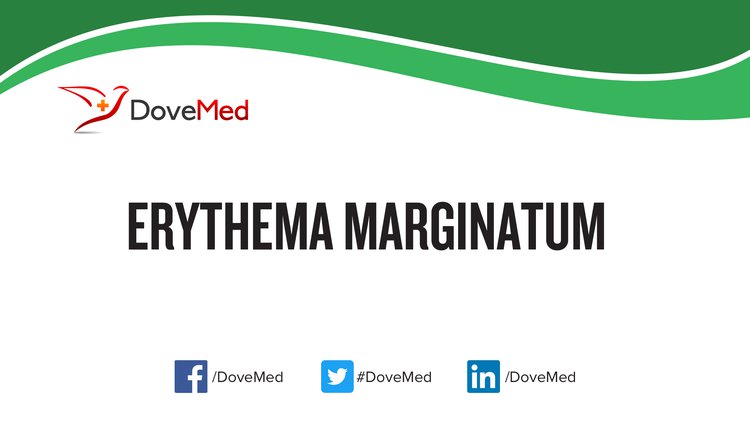 Erythema Marginatum