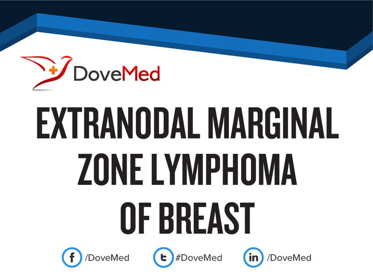 Extranodal Marginal Zone Lymphoma of Breast