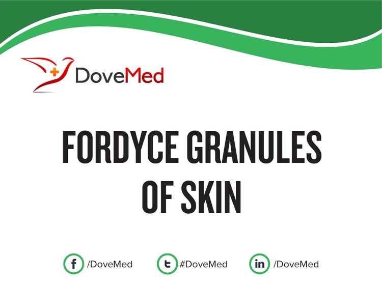 Fordyce Granules of Skin