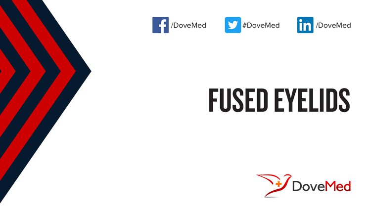 Fused Eyelids