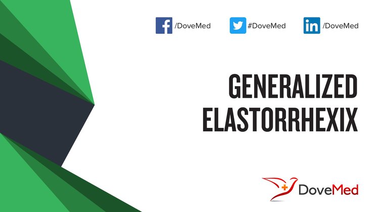 Generalized Elastorrhexix