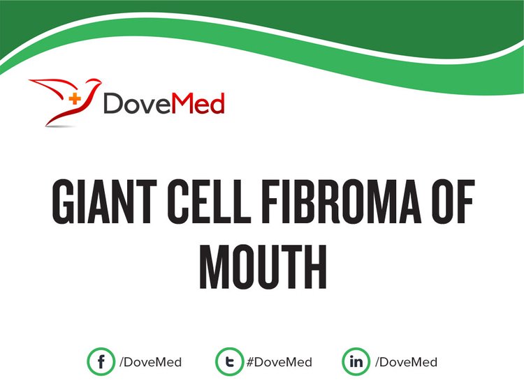 Giant Cell Fibroma of Mouth