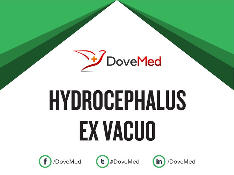 Hydrocephalus Ex Vacuo