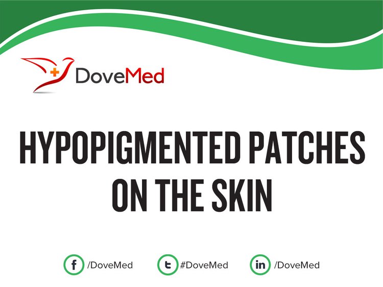 Hypopigmented Patches on the Skin