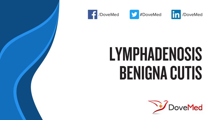 Lymphadenosis Benigna Cutis