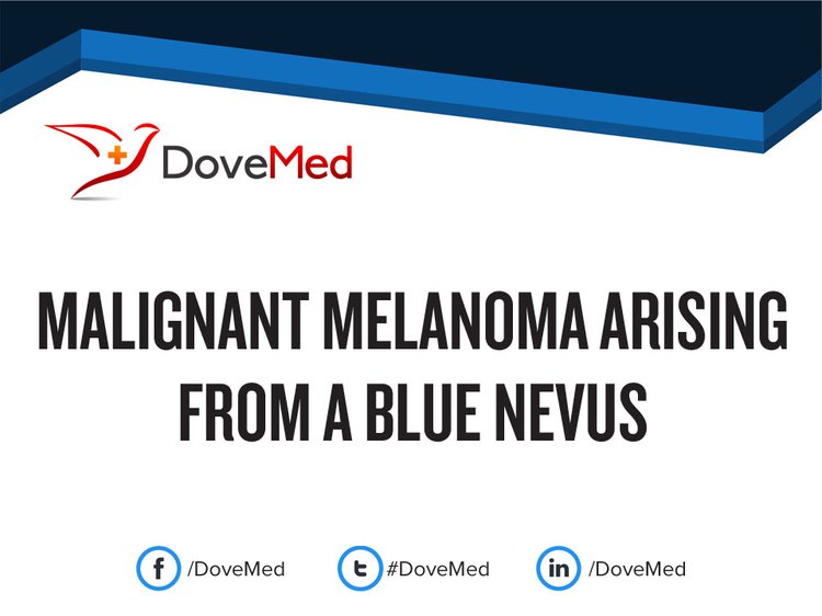 Malignant Melanoma arising from a Blue Nevus