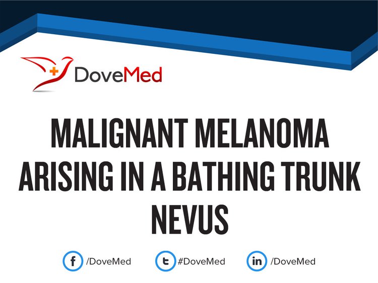 Malignant Melanoma arising in a Bathing Trunk Nevus