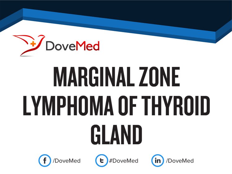 Marginal Zone Lymphoma of Thyroid Gland