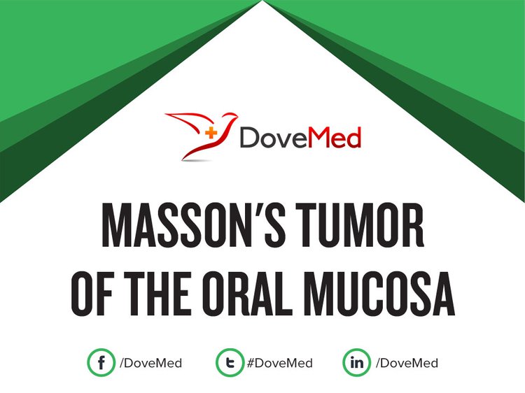 Masson's Tumor of the Oral Mucosa