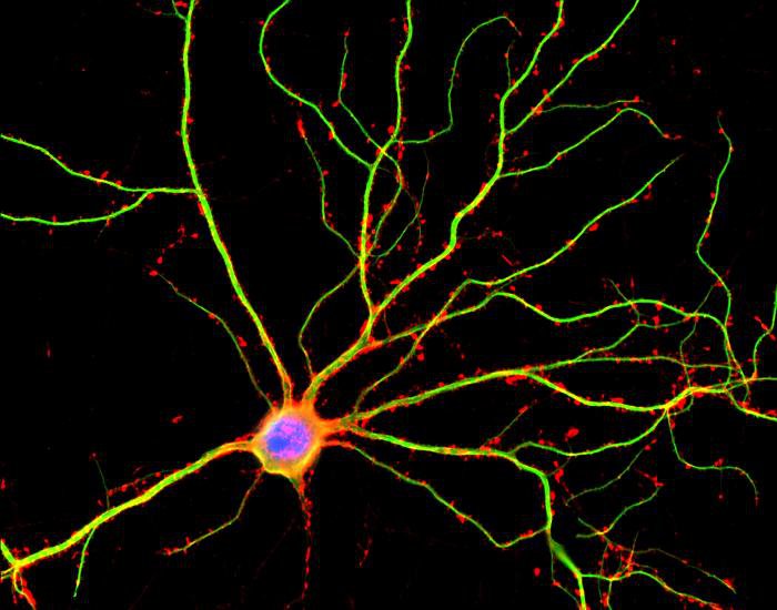 Human Skin Cells Transformed Directly Into Motor Neurons