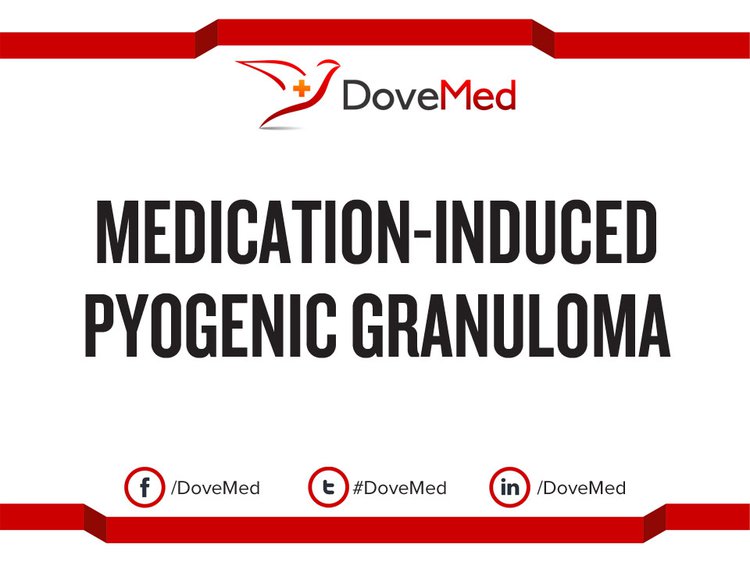 Medication-Induced Pyogenic Granuloma