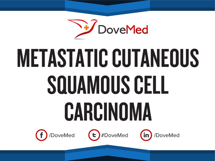 Metastatic Cutaneous Squamous Cell Carcinoma