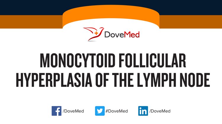 Monocytoid Follicular Hyperplasia of the Lymph Node