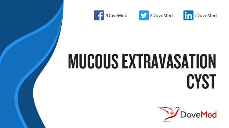 Mucous Extravasation Cyst